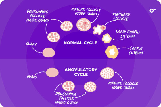 Anovulatory Cycles - Can I Still Get Pregnant? | Expert Guide